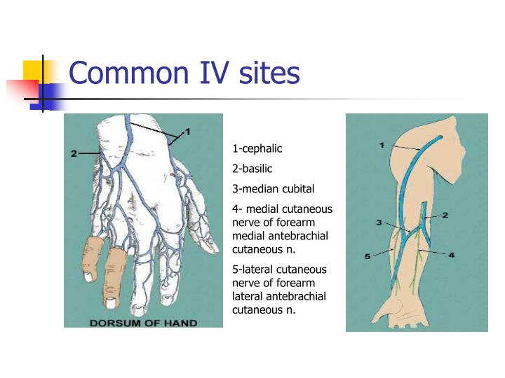 PPT - IV Therapy PowerPoint Presentation - ID:3606785