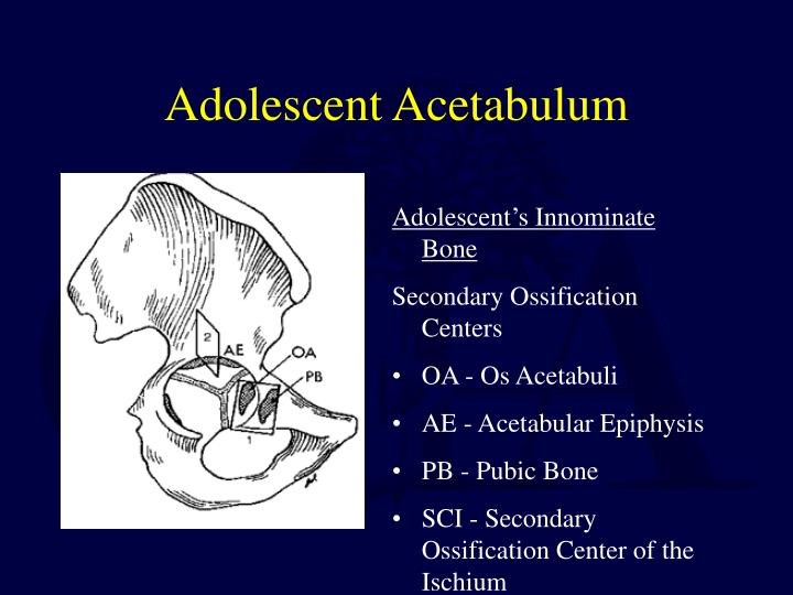PPT - Fractures of the Pelvis and Acetabulum in Pediatric Patients ...