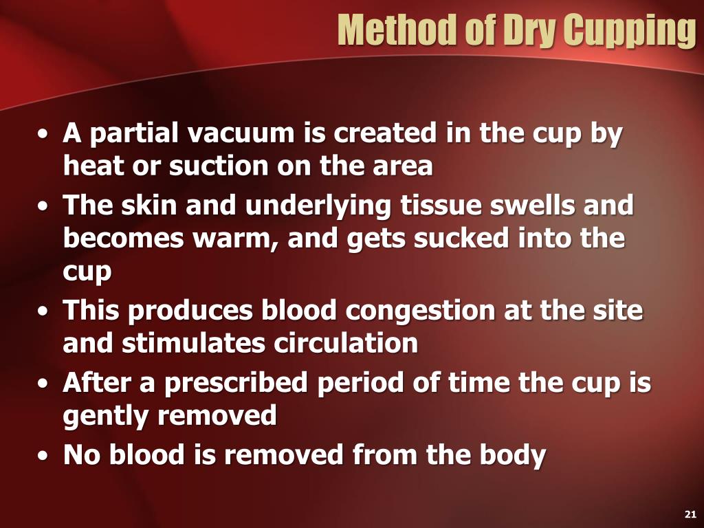 PPT - Al- Hijama (Cupping Therapy) PowerPoint Presentation, free ...