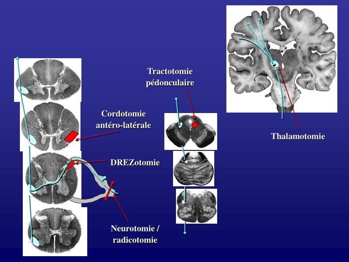 PPT - Physiopathologie de la douleur PowerPoint Presentation - ID:3620434