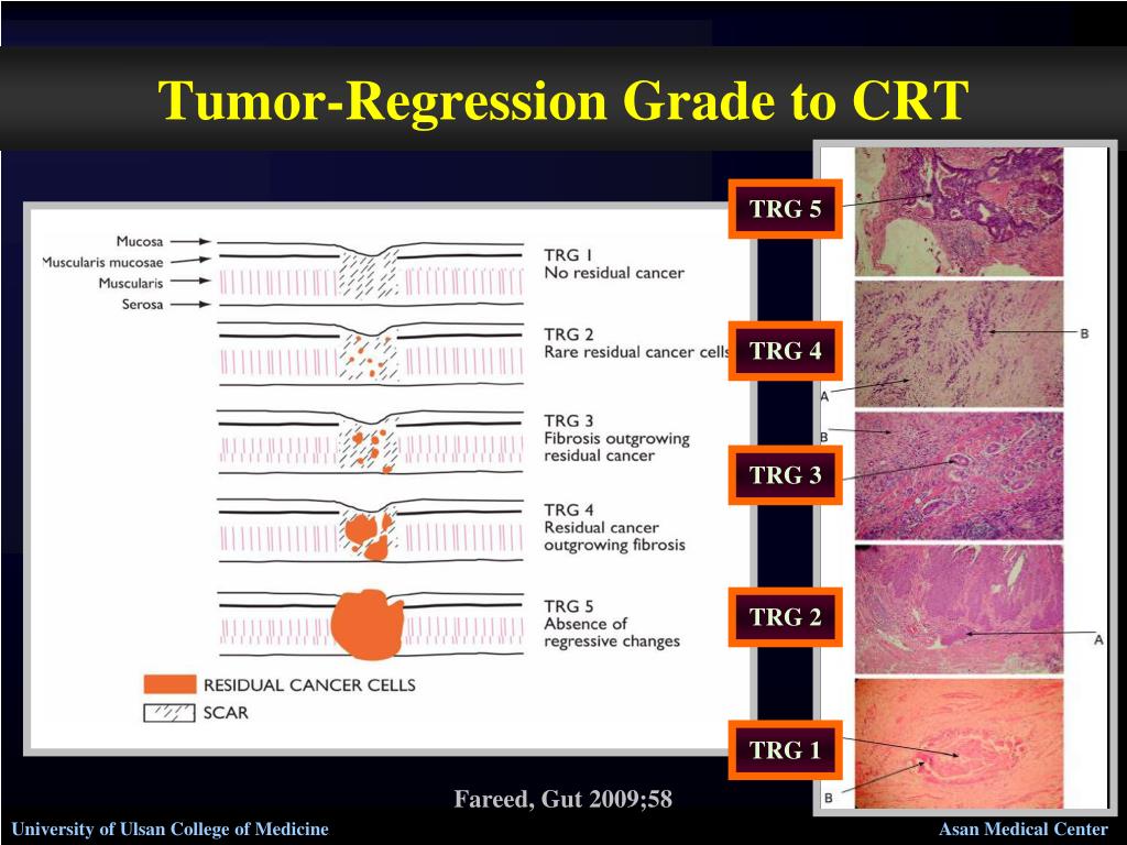 PPT - Induction Therapy for Locally Advanced Esophageal Cancer ... PPT - Induction Therapy for Locally Advanced Esophageal Cancer ...
