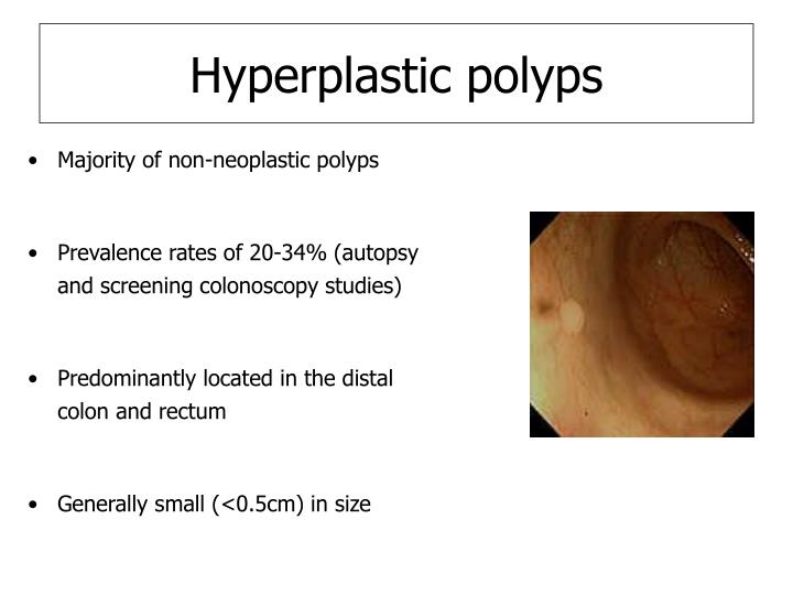 PPT - Colorectal polyps and polyposis syndromes PowerPoint Presentation ...