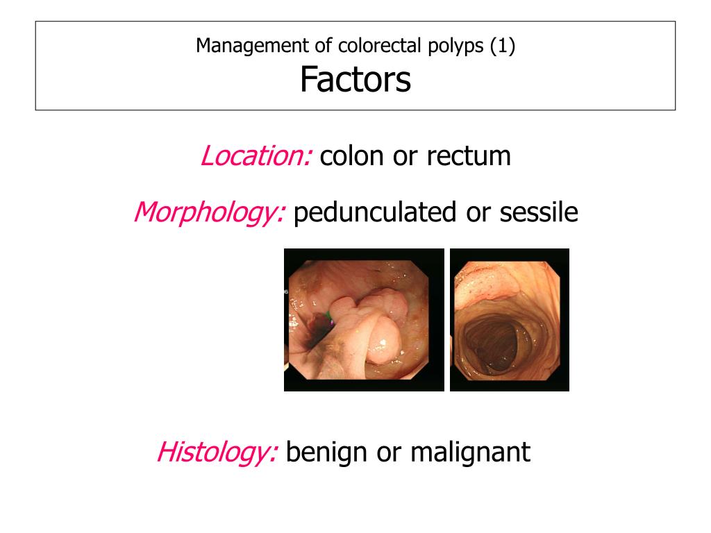 Ppt Colorectal Polyps And Polyposis Syndromes Powerpoint Presentation