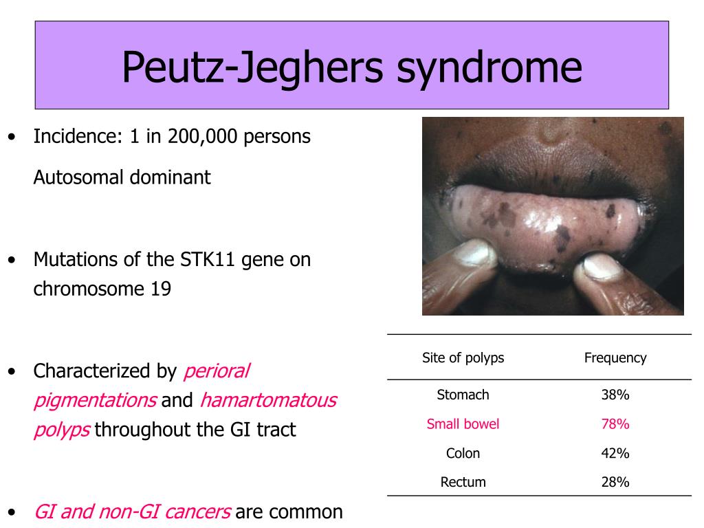 Ppt Colorectal Polyps And Polyposis Syndromes Powerpoint Presentation