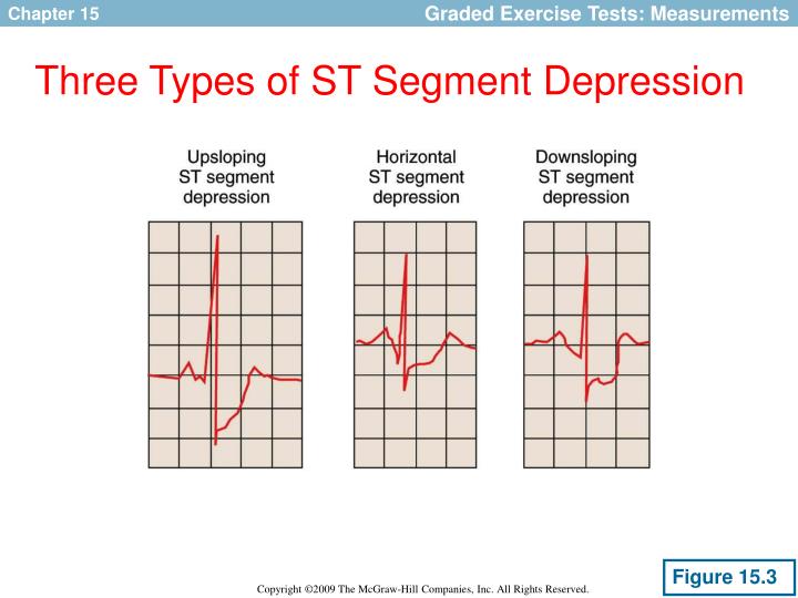 PPT - Work Tests to Evaluate Cardiorespiratory Fitness PowerPoint ...