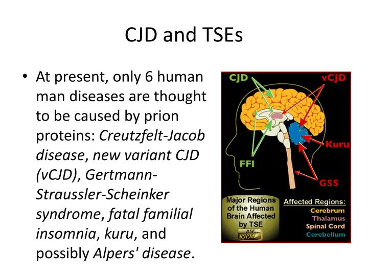 PPT - Creutzfelt-Jacob Disease (CJD) PowerPoint Presentation - ID:3635842