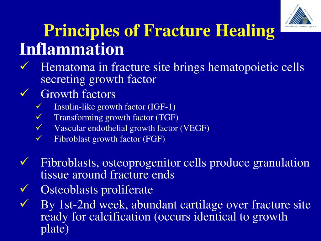 PPT - Principles of Fracture Healing PowerPoint Presentation, free ... PPT - Principles of Fracture Healing PowerPoint Presentation, free ...