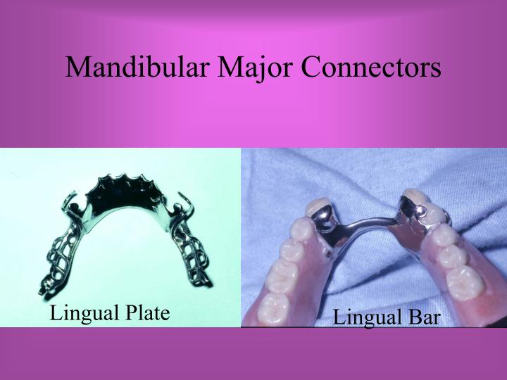 PPT - CLASP RETAINED REMOVABLE PARTIAL DENTURES PowerPoint Presentation ...