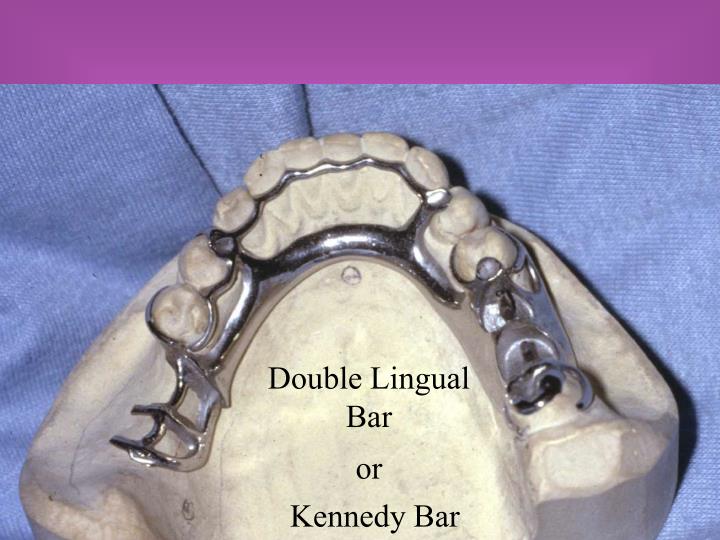 PPT - CLASP RETAINED REMOVABLE PARTIAL DENTURES PowerPoint Presentation ...