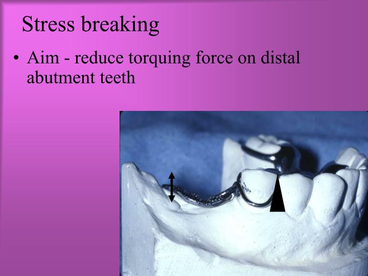 PPT - CLASP RETAINED REMOVABLE PARTIAL DENTURES PowerPoint Presentation ...