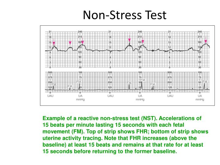PPT - Assessment of Fetal Well-Being PowerPoint Presentation - ID:3652599