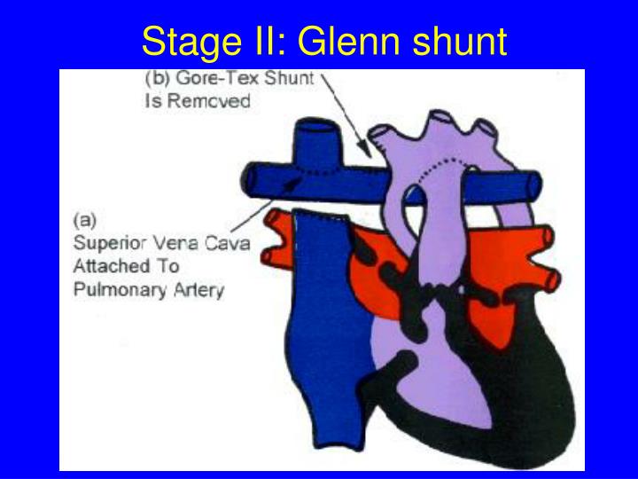 PPT - Congenital Heart Lesions PowerPoint Presentation - ID:3653394