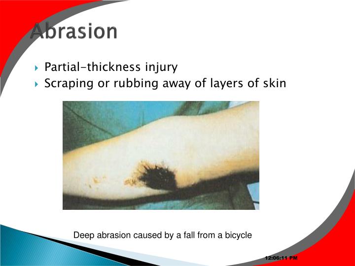 PPT - FIRST AID AWARENESS PowerPoint Presentation - ID:3653481
