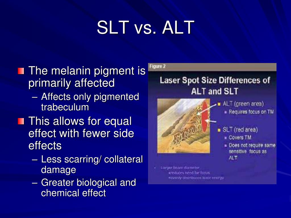 PPT Glaucoma Laser Surgery SLT ALT ECP PowerPoint Presentation PPT Glaucoma Laser Surgery SLT ALT ECP PowerPoint Presentation
