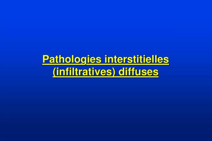PPT - Pathologies interstitielles (infiltratives) diffuses PowerPoint ...