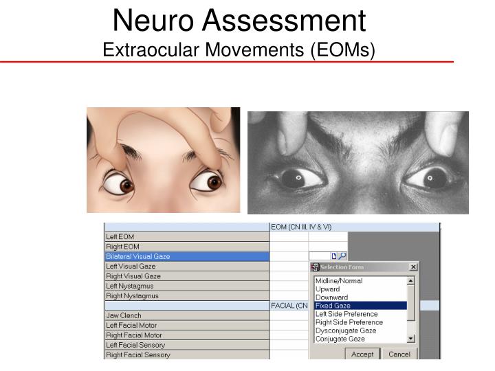 PPT - Advanced Neuro Assessment PowerPoint Presentation - ID:3662384