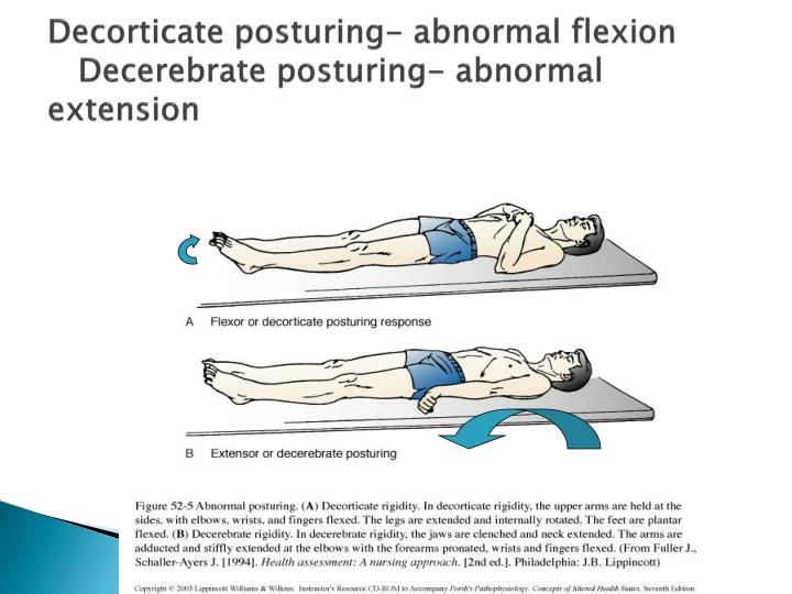 PPT - Altered Cerebral Function & Increased Intracranial Pressure ...