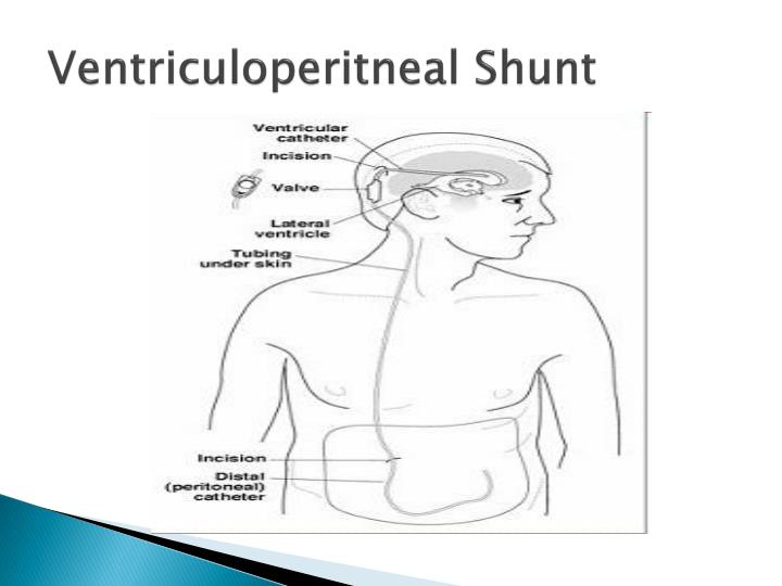 PPT - Altered Cerebral Function & Increased Intracranial Pressure ...