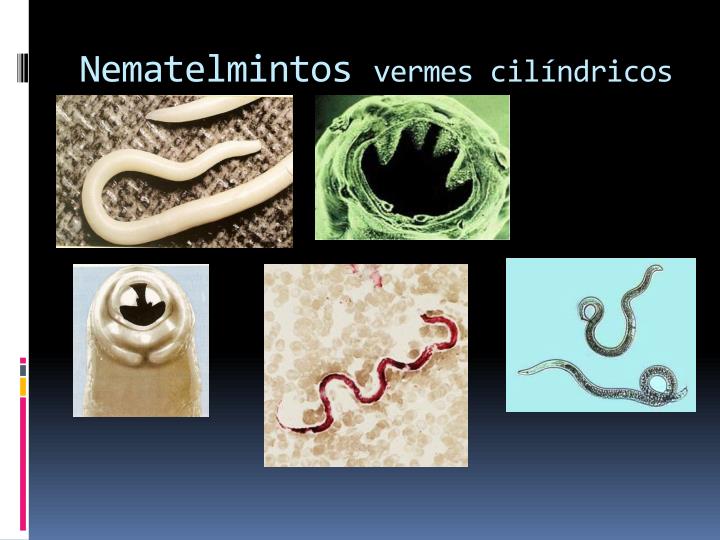 PPT - Platelmintos e Nematelmintos Verminoses Características ...