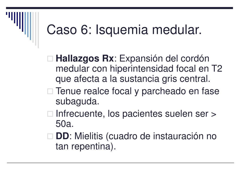 PPT - Tumoraciones intrarraquídeas e imitadores PowerPoint Presentation ...