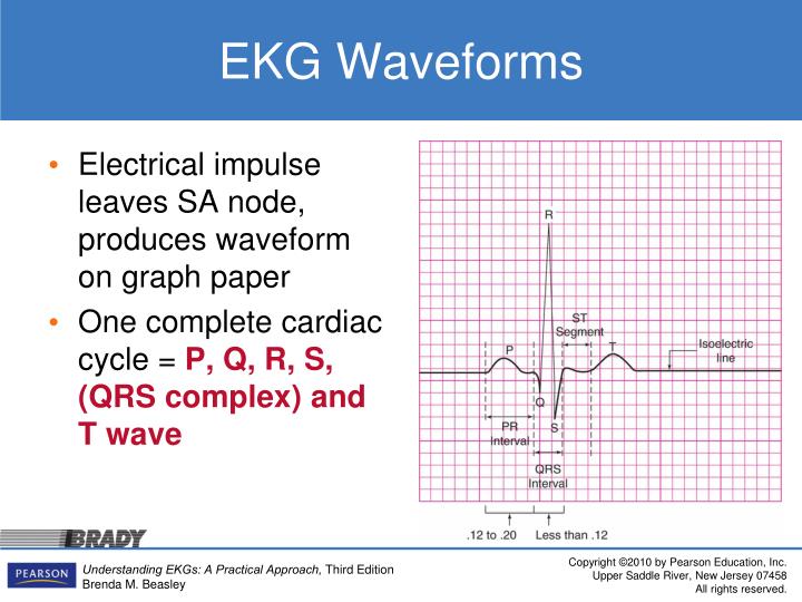 PPT - The Electrocardiogram PowerPoint Presentation - ID:3672004