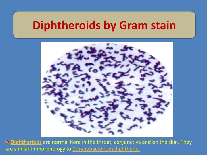 PPT - Corynebacterium diphtheriae PowerPoint Presentation - ID:3672369