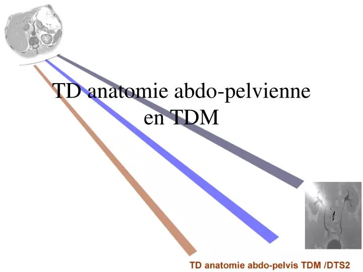 PPT - TD anatomie abdo-pelvienne en TDM PowerPoint Presentation, free ...