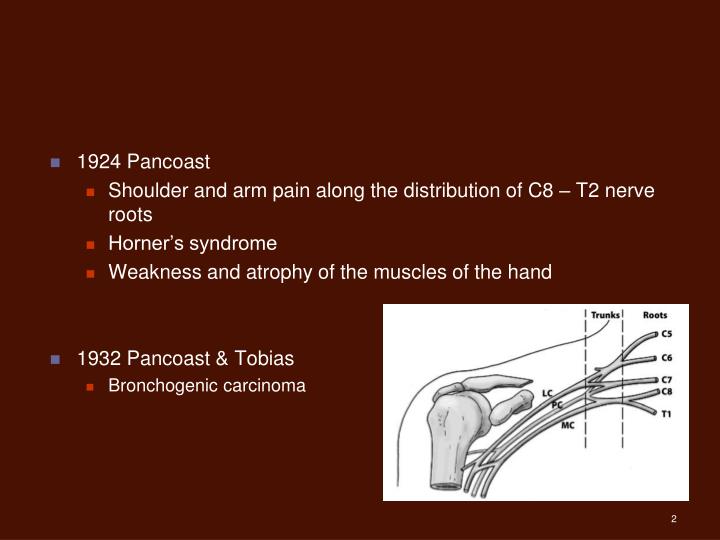 PPT - Superior Sulcus Tumors PowerPoint Presentation - ID:3686708
