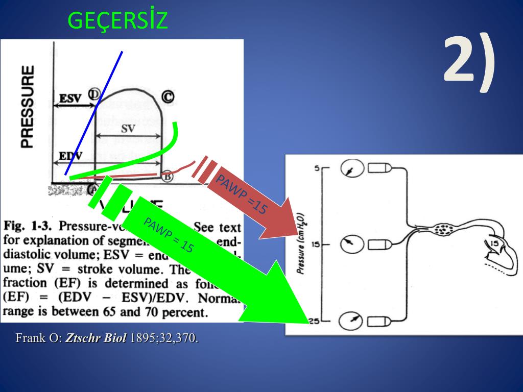 PPT - Sepsis, Septik Ş ok ve Hemodinamik Moniterizasyon PowerPoint ...