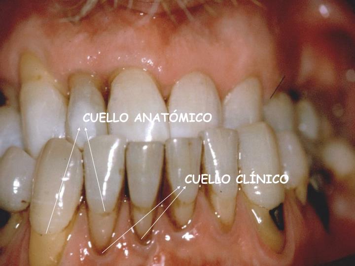 PPT - SISTEMA DENTARIO PowerPoint Presentation - ID:3689086