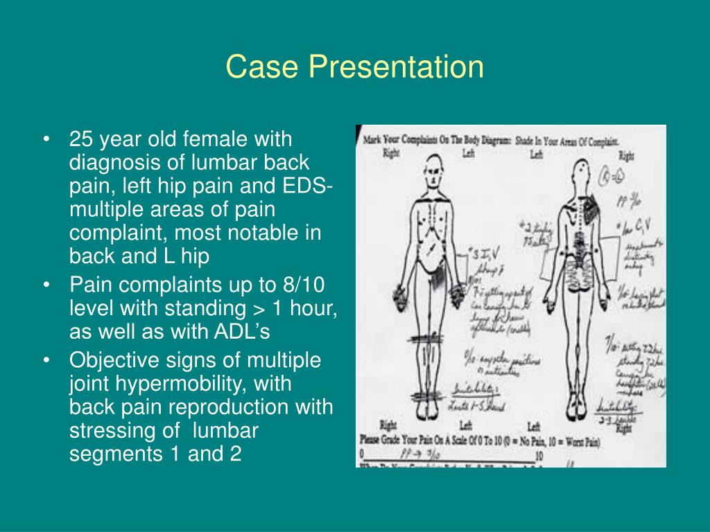 PPT - Physical Therapy Management of the Hypermobile Patient PowerPoint ...