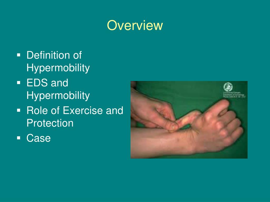 PPT - Physical Therapy Management of the Hypermobile Patient PowerPoint ...