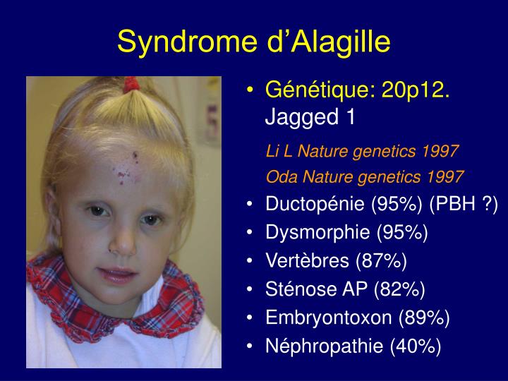 PPT - ICTERES CHOLESTATIQUES et CHOLESTASES DU NOURRISSON PowerPoint ...