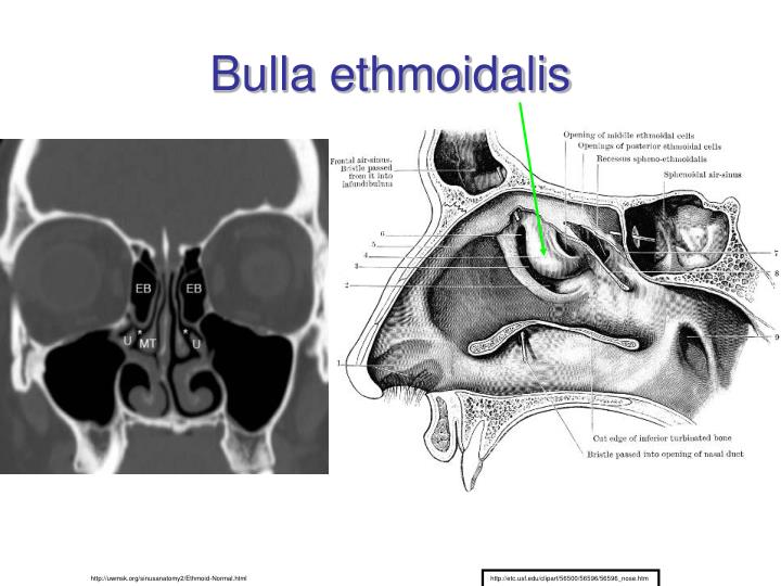 PPT - Respiratory system I. PowerPoint Presentation - ID:3690384