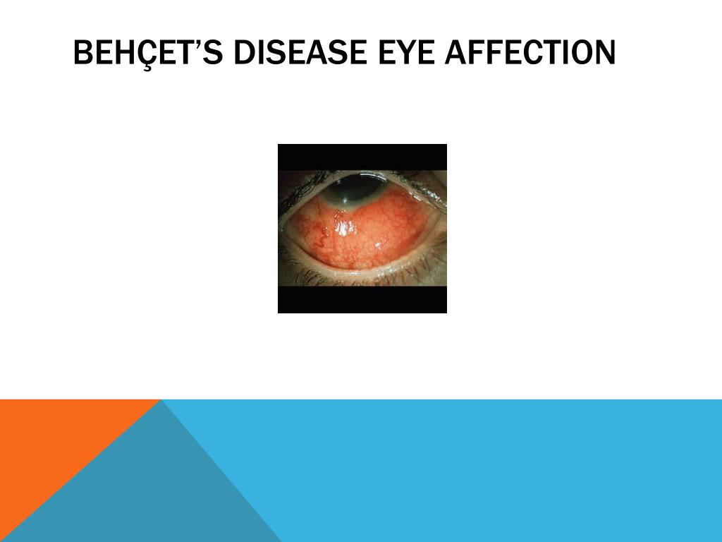 PPT - SKIN MANIFESTATIONS OF CELIAC DISEASE صــور د. إبراهيم الصيـــاد ...