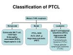 PPT - Mantle Cell Lymphoma (MCL): Approach to Upfront Treatment ...
