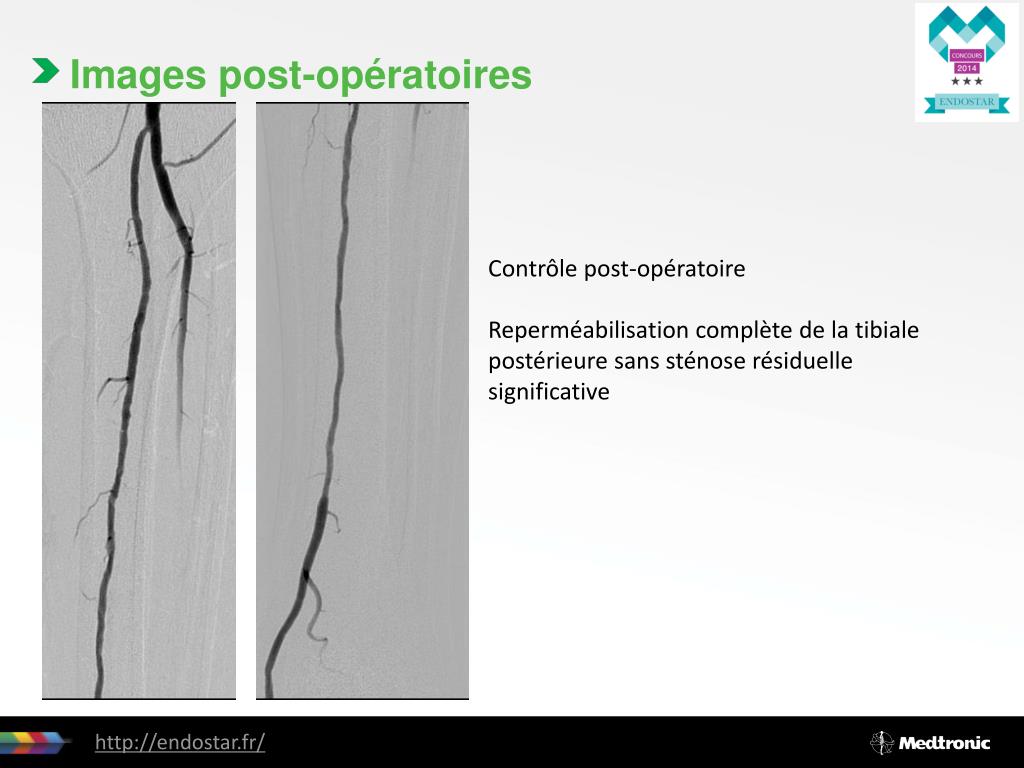 PPT - 2014 PowerPoint Presentation, free download - ID:3694405