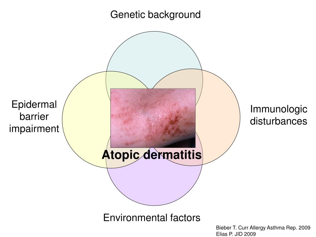PPT - Atopic Dermatitis and Contact Allergy: Understanding Genetic ...