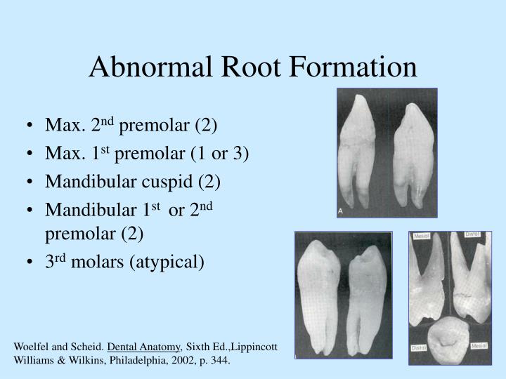 PPT - Dental Anomalies PowerPoint Presentation - ID:3700780
