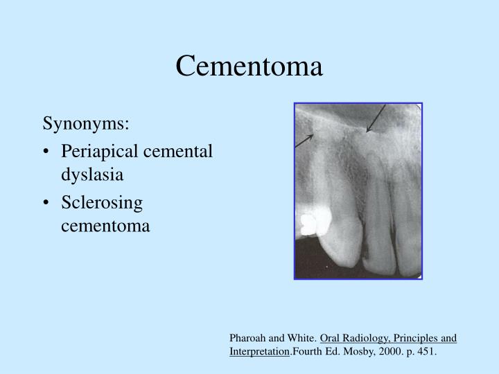 PPT - Dental Anomalies PowerPoint Presentation - ID:3700780