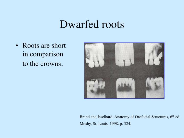 PPT - Dental Anomalies PowerPoint Presentation - ID:3700780