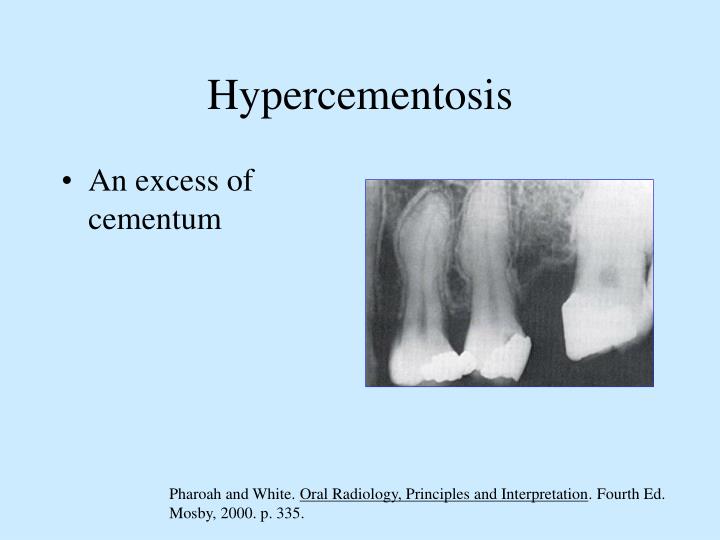 PPT - Dental Anomalies PowerPoint Presentation - ID:3700780