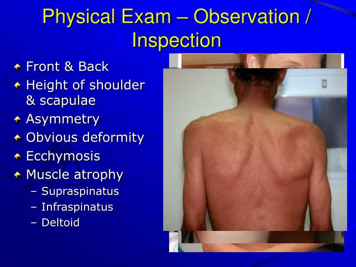 PPT - History & Physical Examination of the Shoulder PowerPoint ...