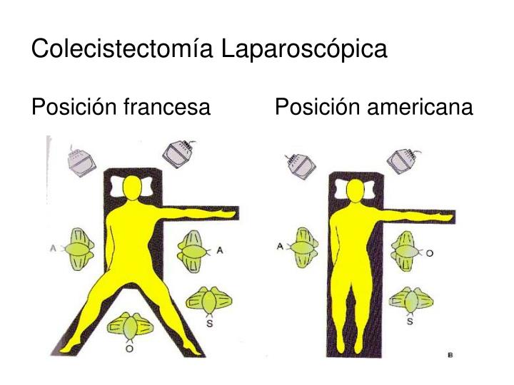 PPT - Colecistectomía Laparoscópica PowerPoint Presentation - ID:3705399