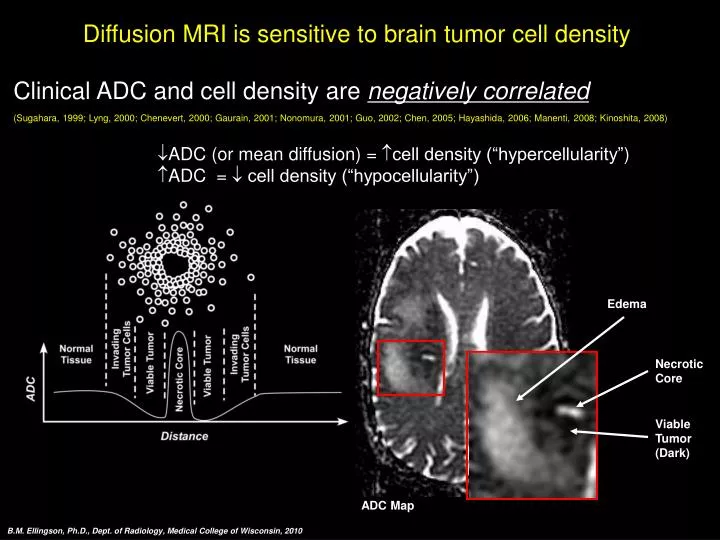 PPT - Diffusion MRI is sensitive to brain tumor cell density PowerPoint ...