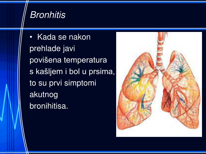 PPT - Njega i bolesti organa za disanje PowerPoint Presentation - ID ...