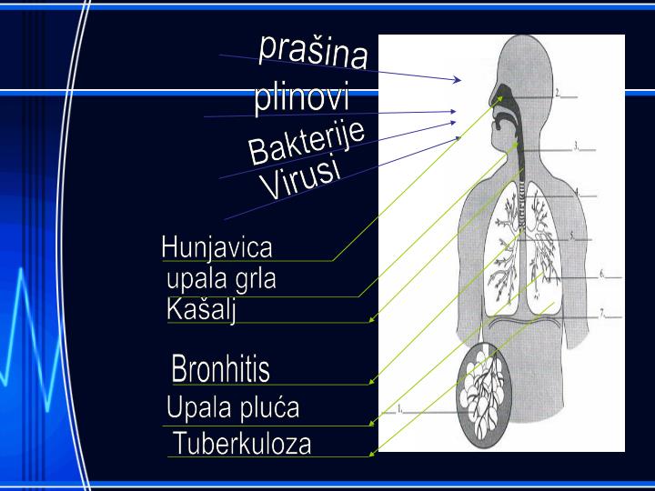 PPT - Njega i bolesti organa za disanje PowerPoint Presentation - ID ...