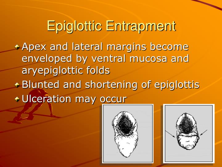 PPT - Epiglottic Entrapment in Horses PowerPoint Presentation - ID:3710487