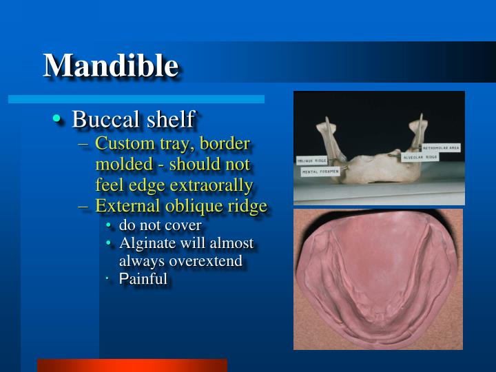 PPT - Complete Denture Diagnosis & Treatment Planning PowerPoint ...