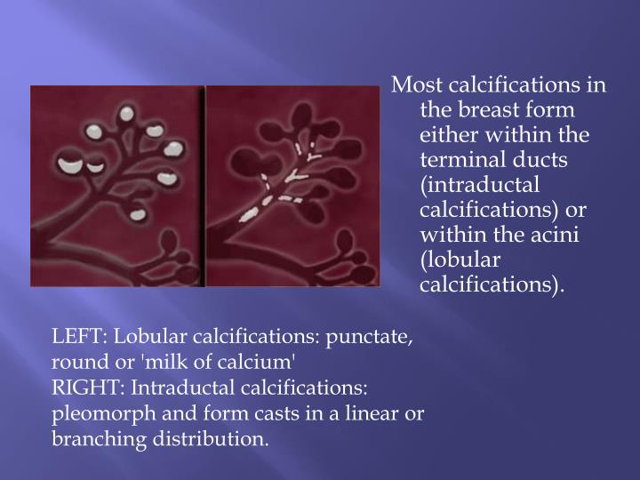 PPT - Breast Calcifications - Differential diagnosis and BIRADS ...